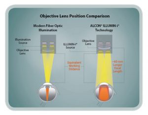 Alcon Launches LuxOR™ Surgical Ophthalmic Microscope - Surgical Direct Inc